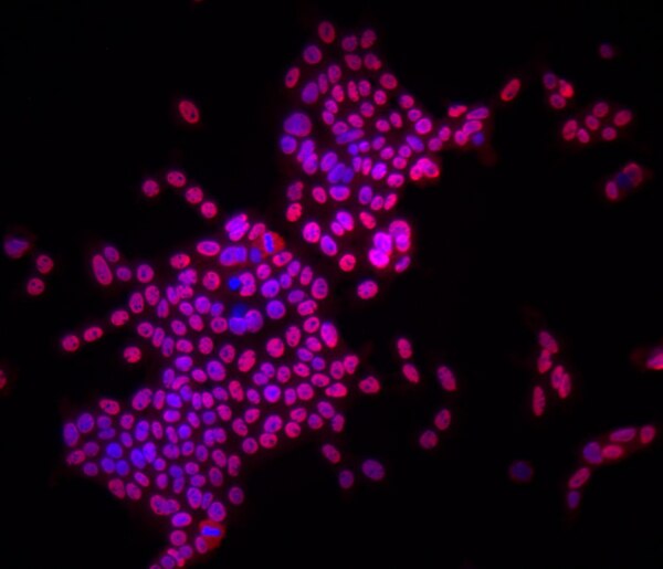 Mouse mammary tumor cell line TUBO | SCC222